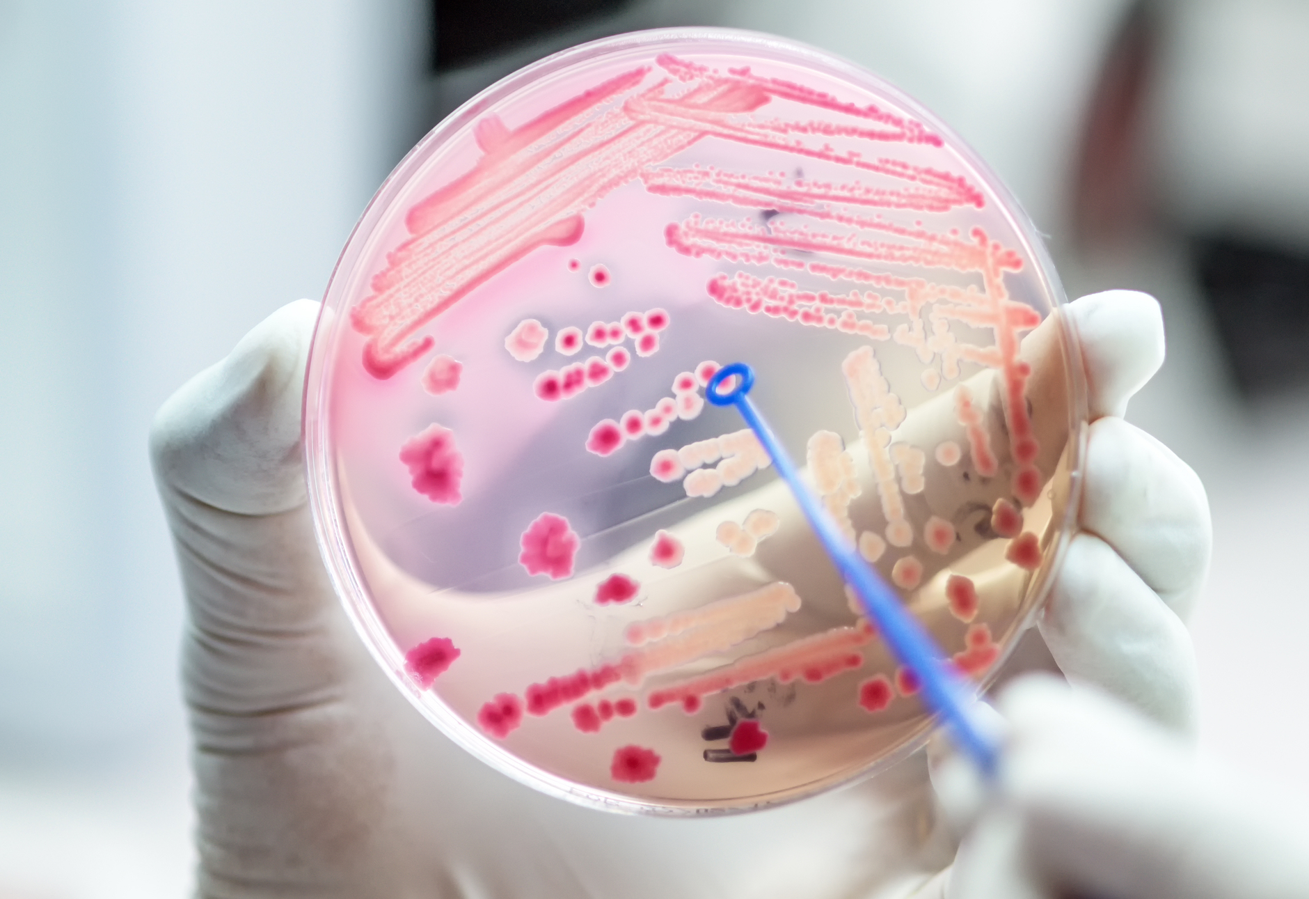 Research shows link between antimicrobial resistance and climate change ...
