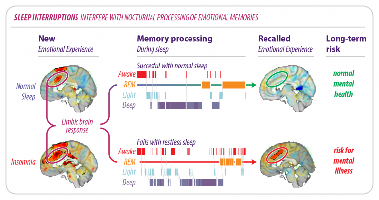 Insomnia strengthens distressing and shameful memories - Earth.com