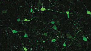 Newly discovered hunger pathway is activated in the presence of food ...