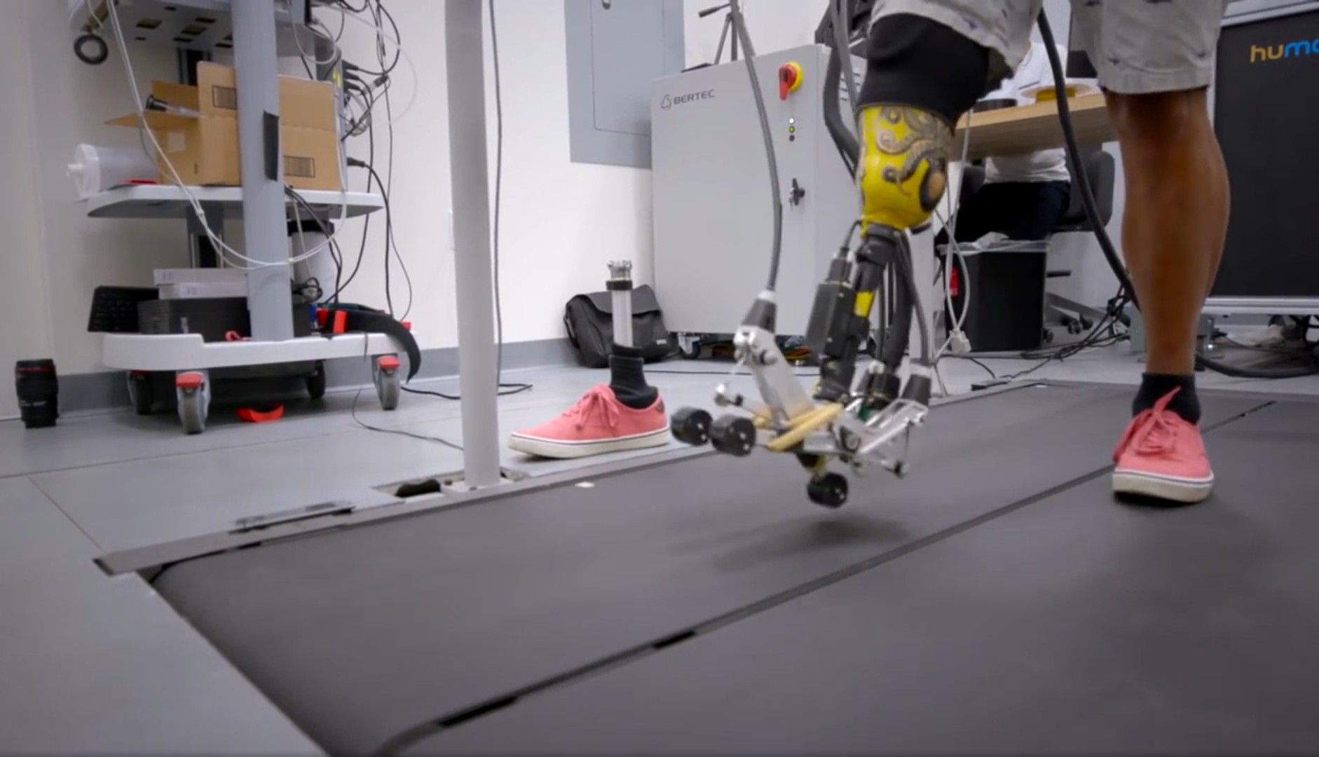 New tool for designing prosthetic limbs - Earth.com