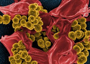 How Do Bacteria Reproduce - Earth.com