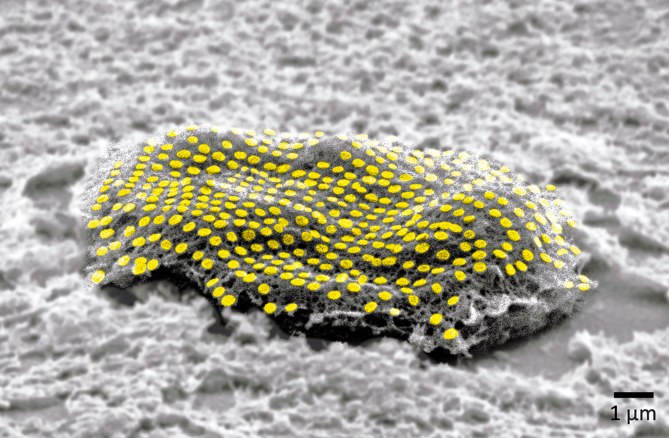 Scientists can now put nanoscale tattoos onto individual cells inside ...