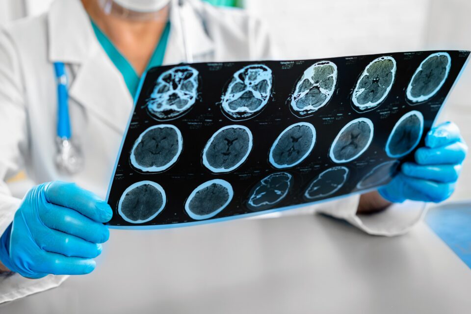 Long-COVID brain changes detected by advanced MRI technology • Earth.com