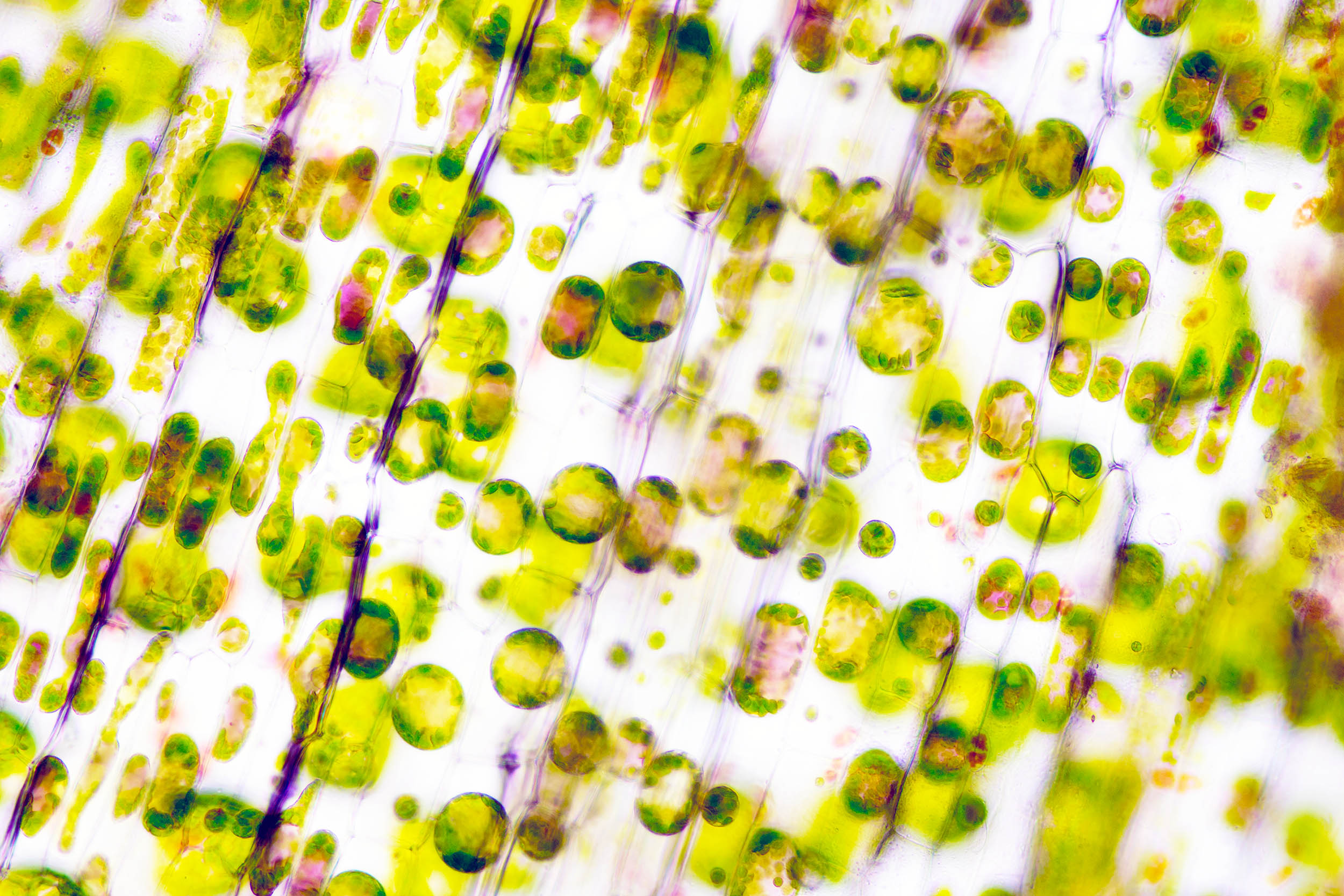 Plants have a sophisticated defense system when pathogens attack ...