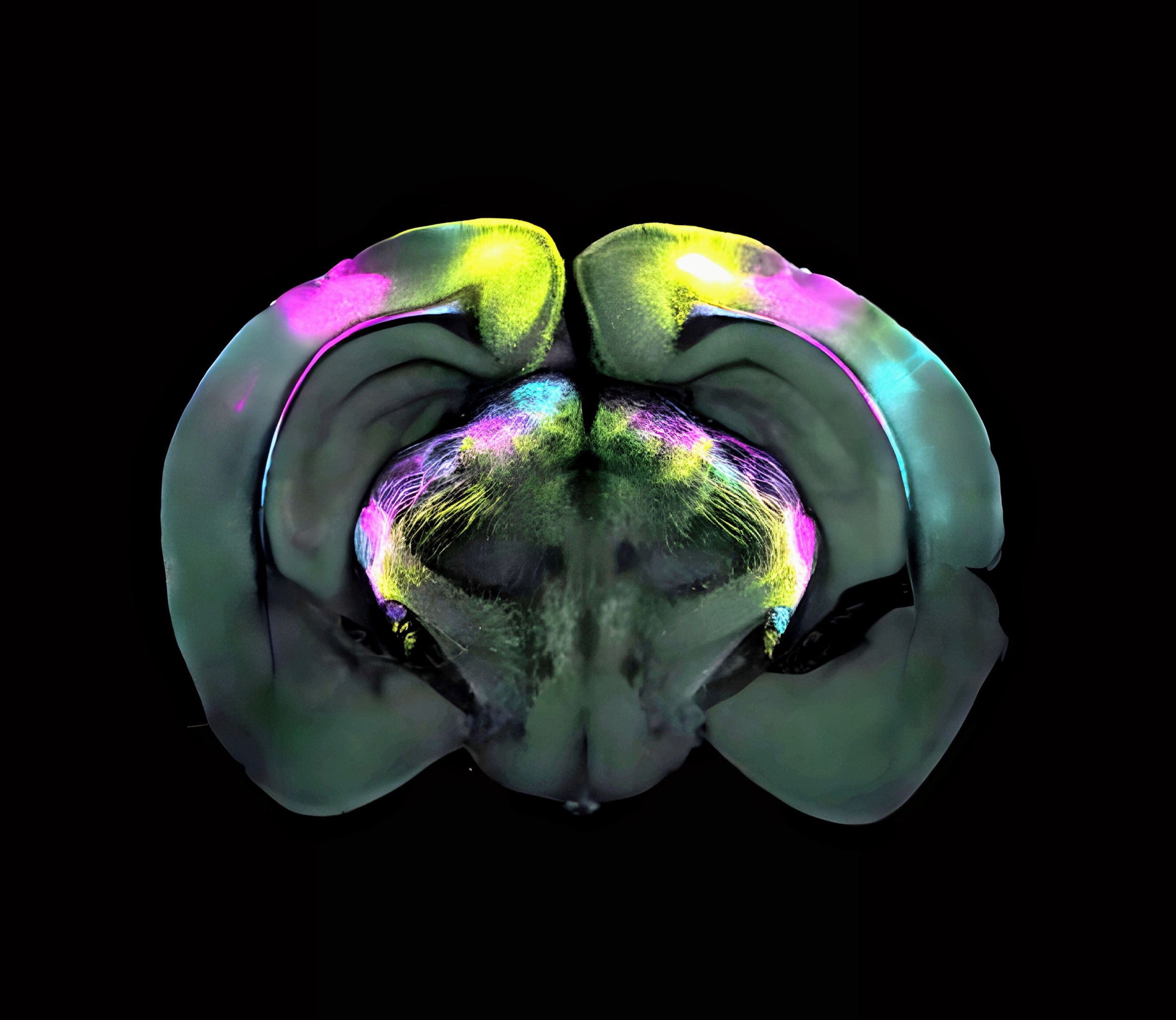 Brain pathway discovered that suppresses fear - Earth.com