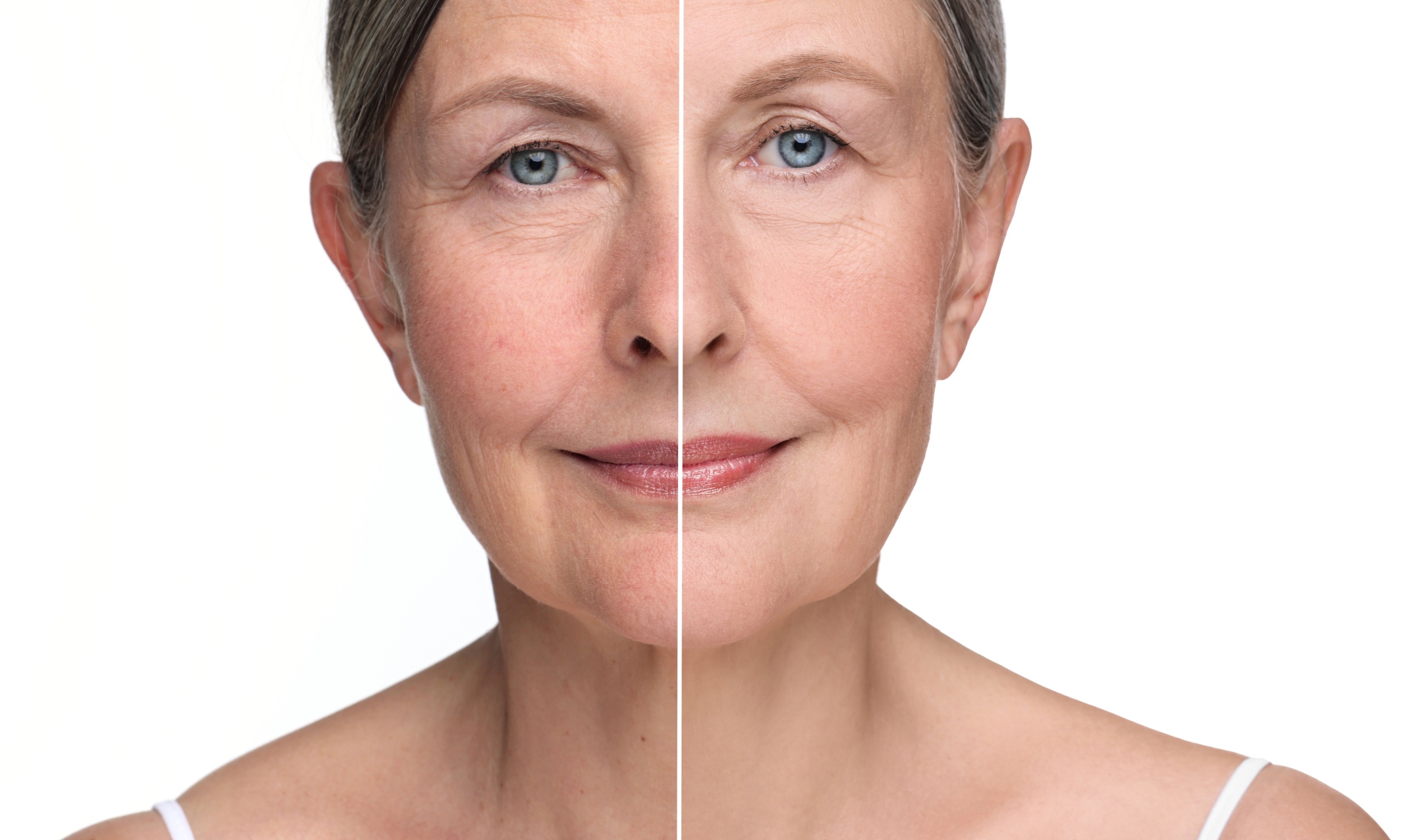 Hormones may slow skin aging and reduce wrinkles - Earth.com