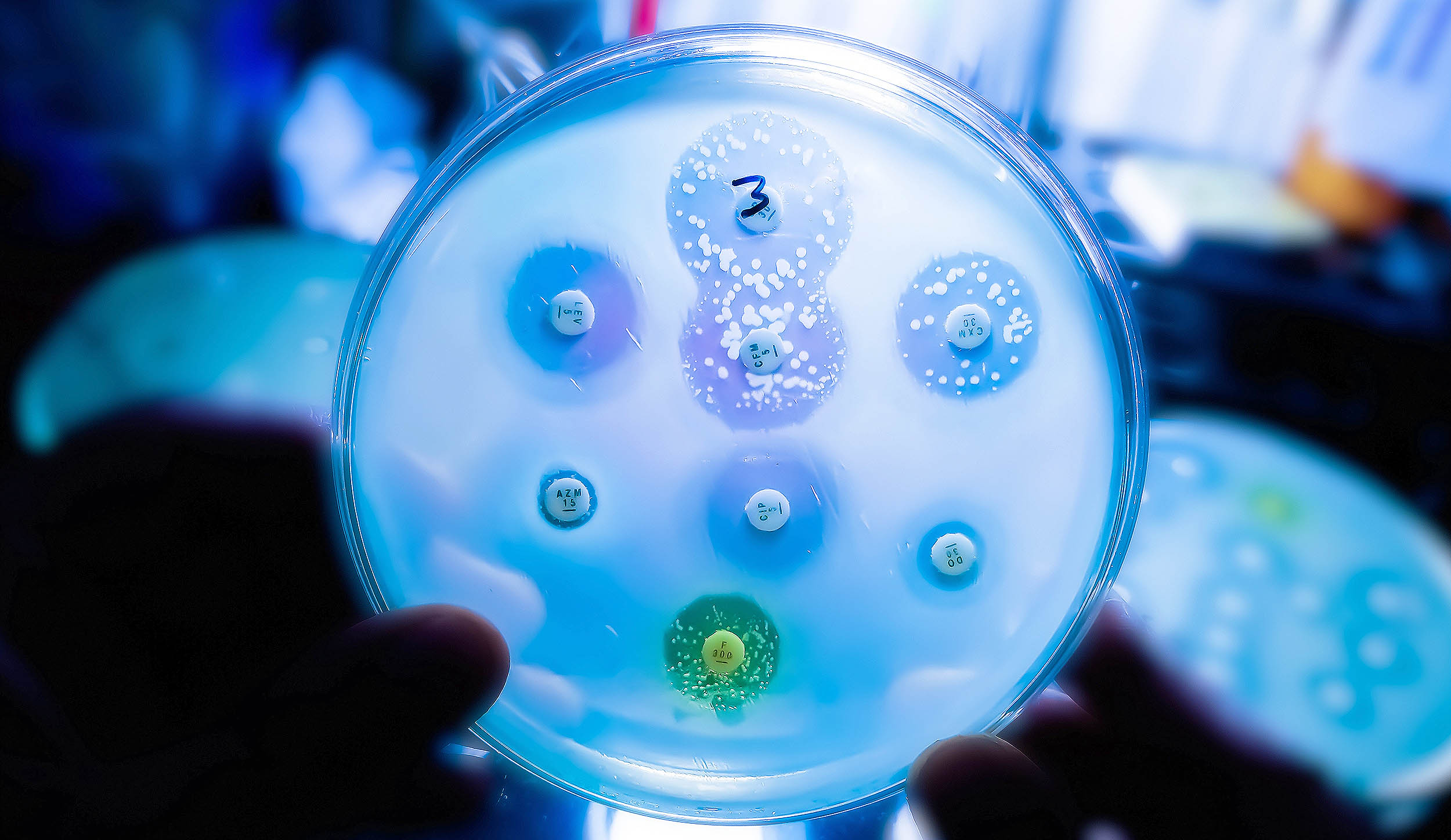 New "superbugs" discovered in hospitals eat medical plastics - Earth.com