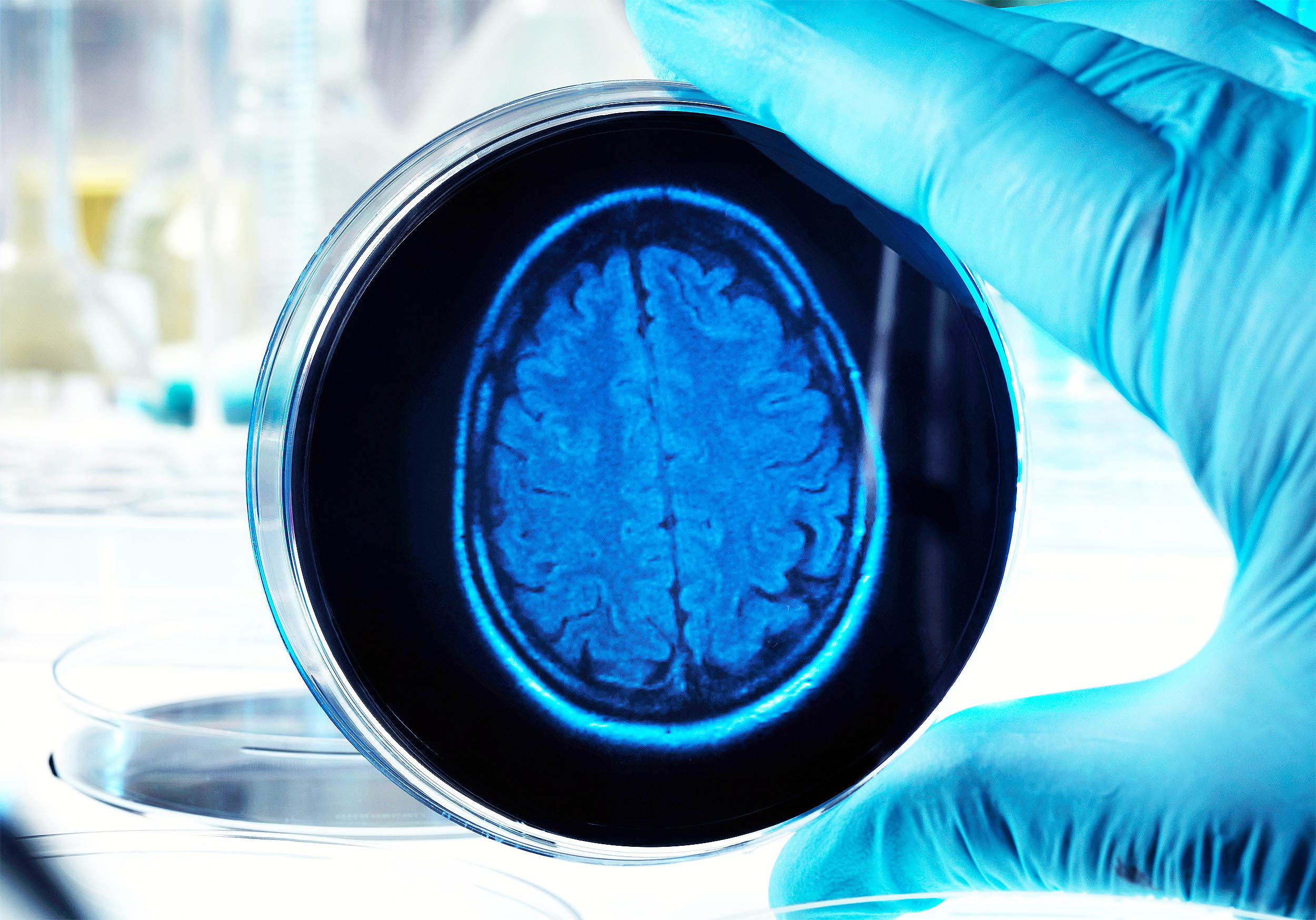 "Mini-brains" created in the lab to help fight neurological diseases - Earth.com