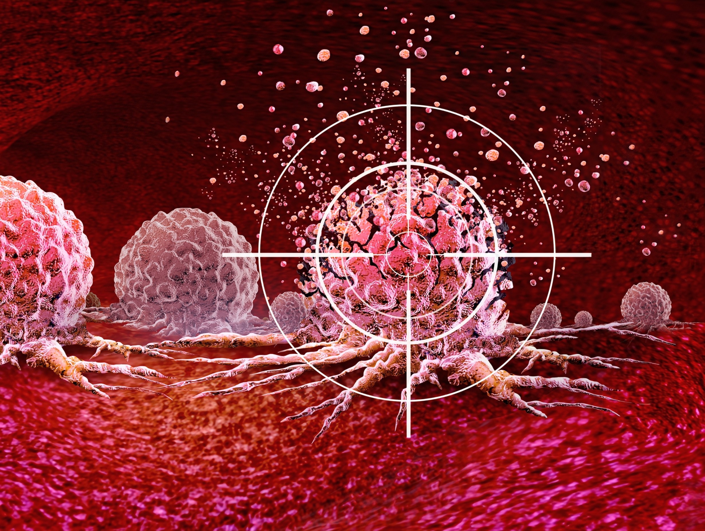Freezing molecules could halt the spread of brain cancer - Earth.com