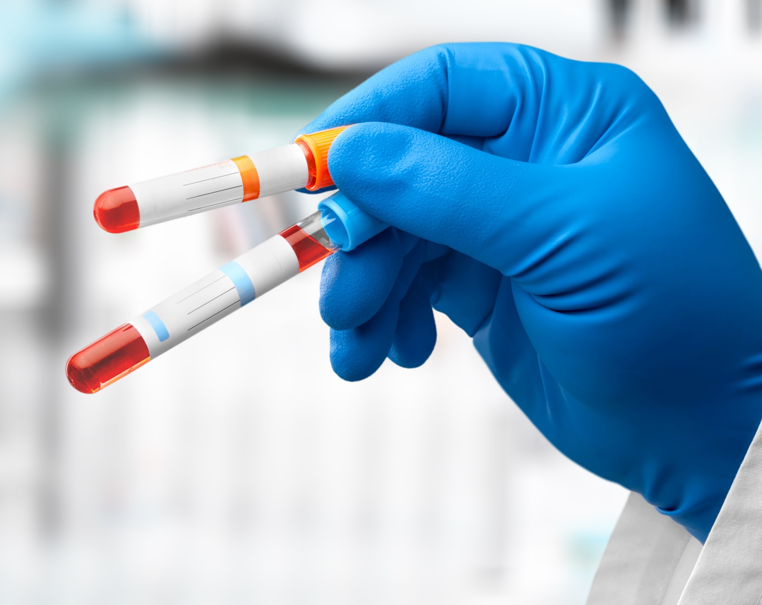 New blood test shows how fast our organs are aging - Earth.com