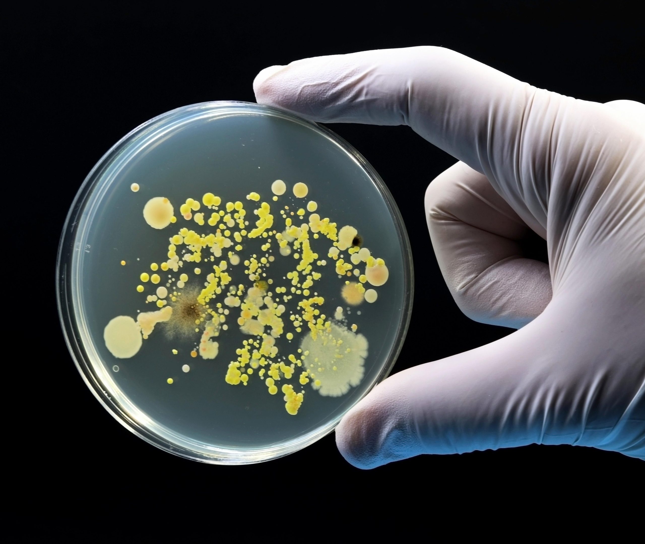 Hospitals face mounting crisis as superbug infections spread - Earth.com