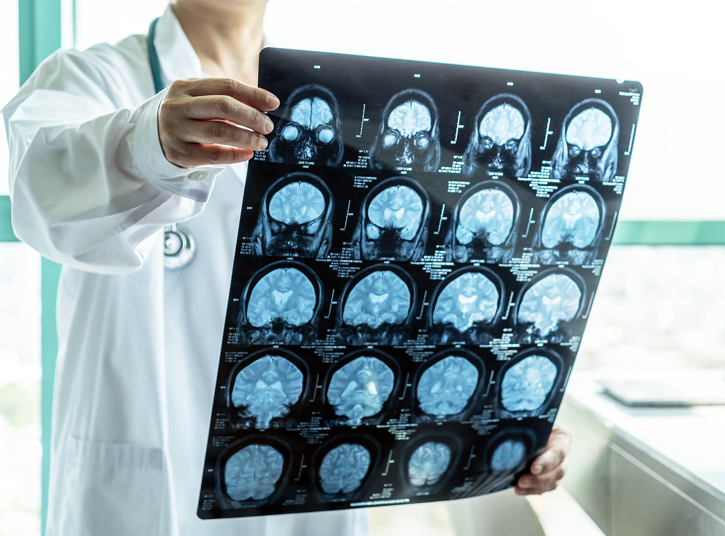 Simple habits can keep you sharp and slow brain aging - Earth.com