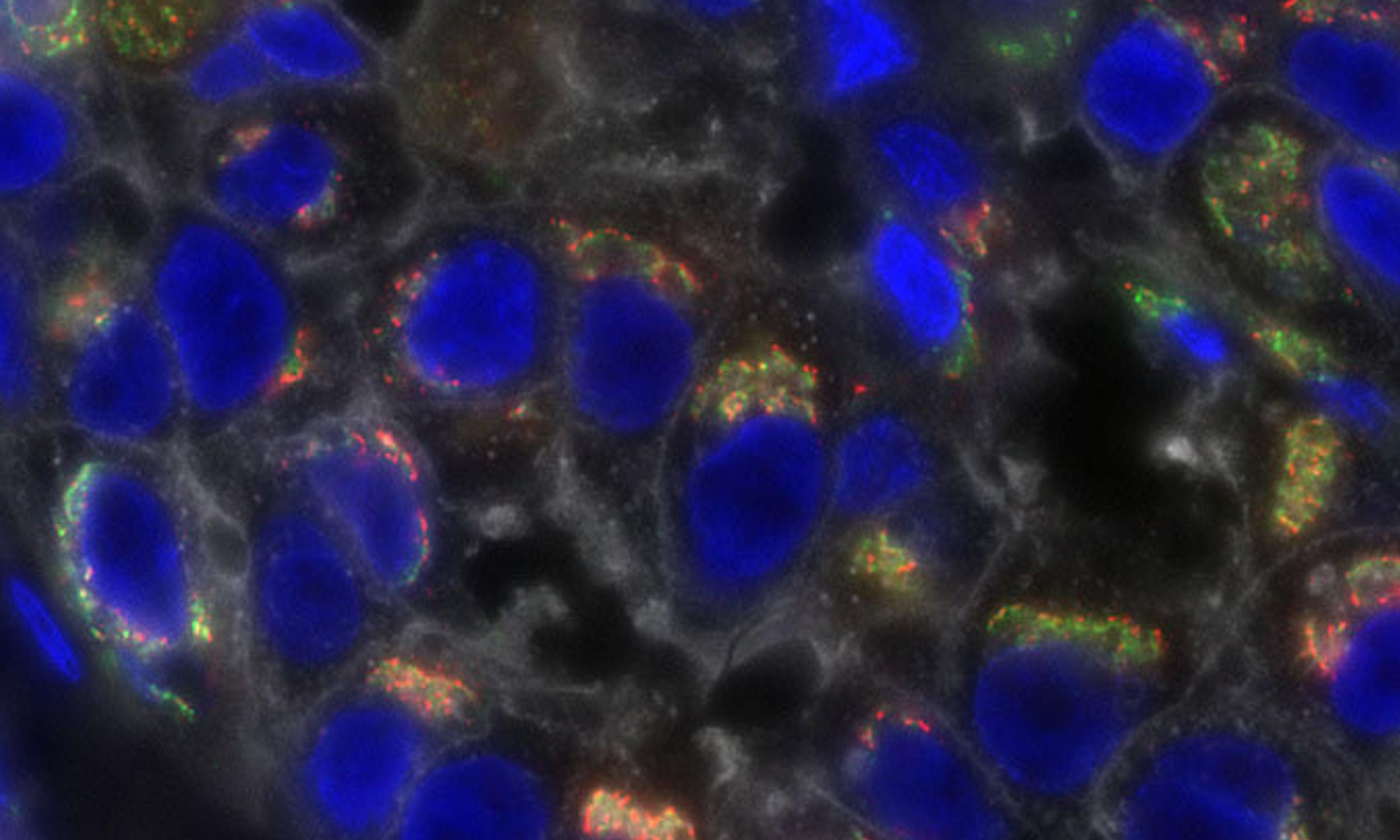 New vaccine research targets aggressive breast cancer - Earth.com