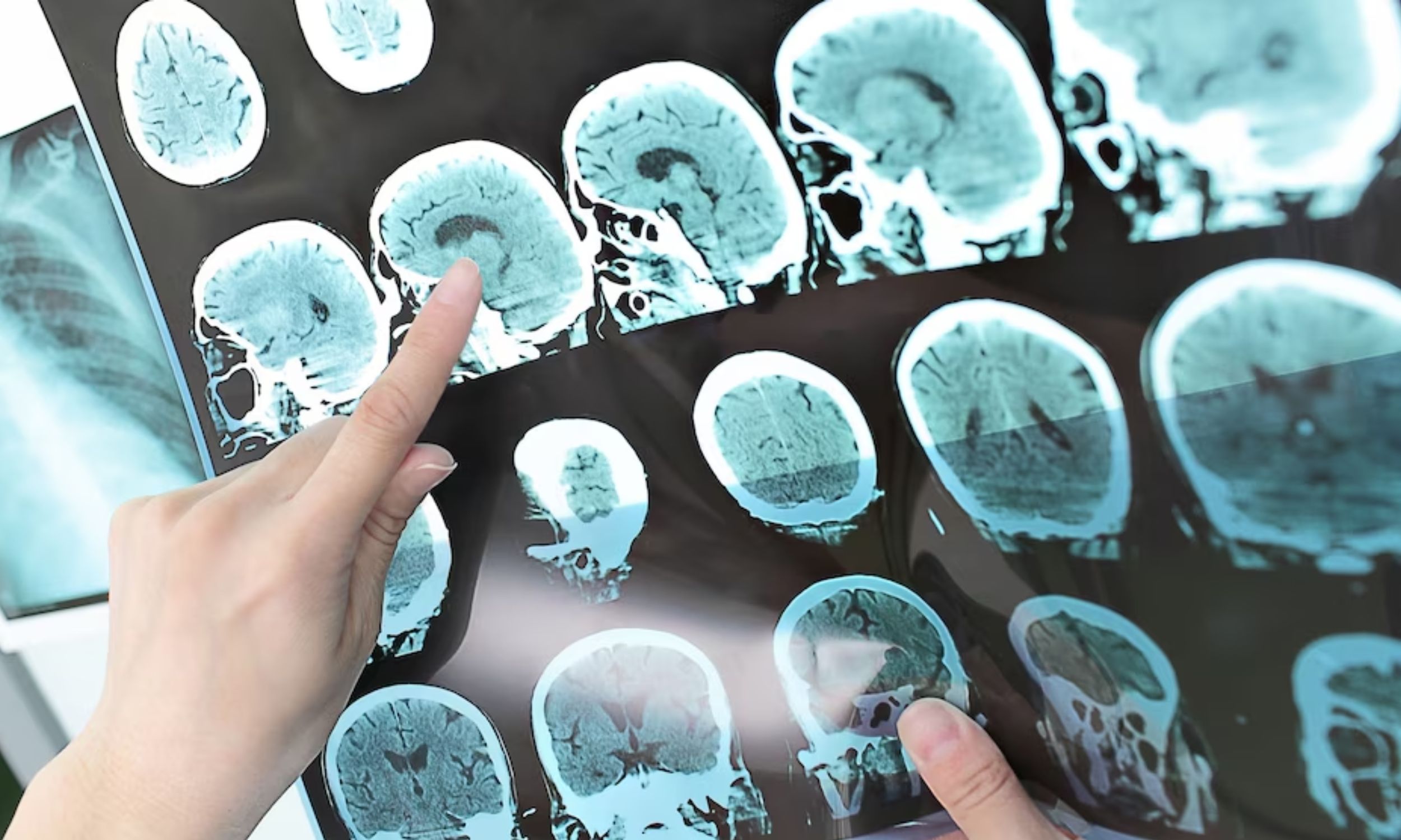 New device translates silent speech in stroke patients - Earth.com