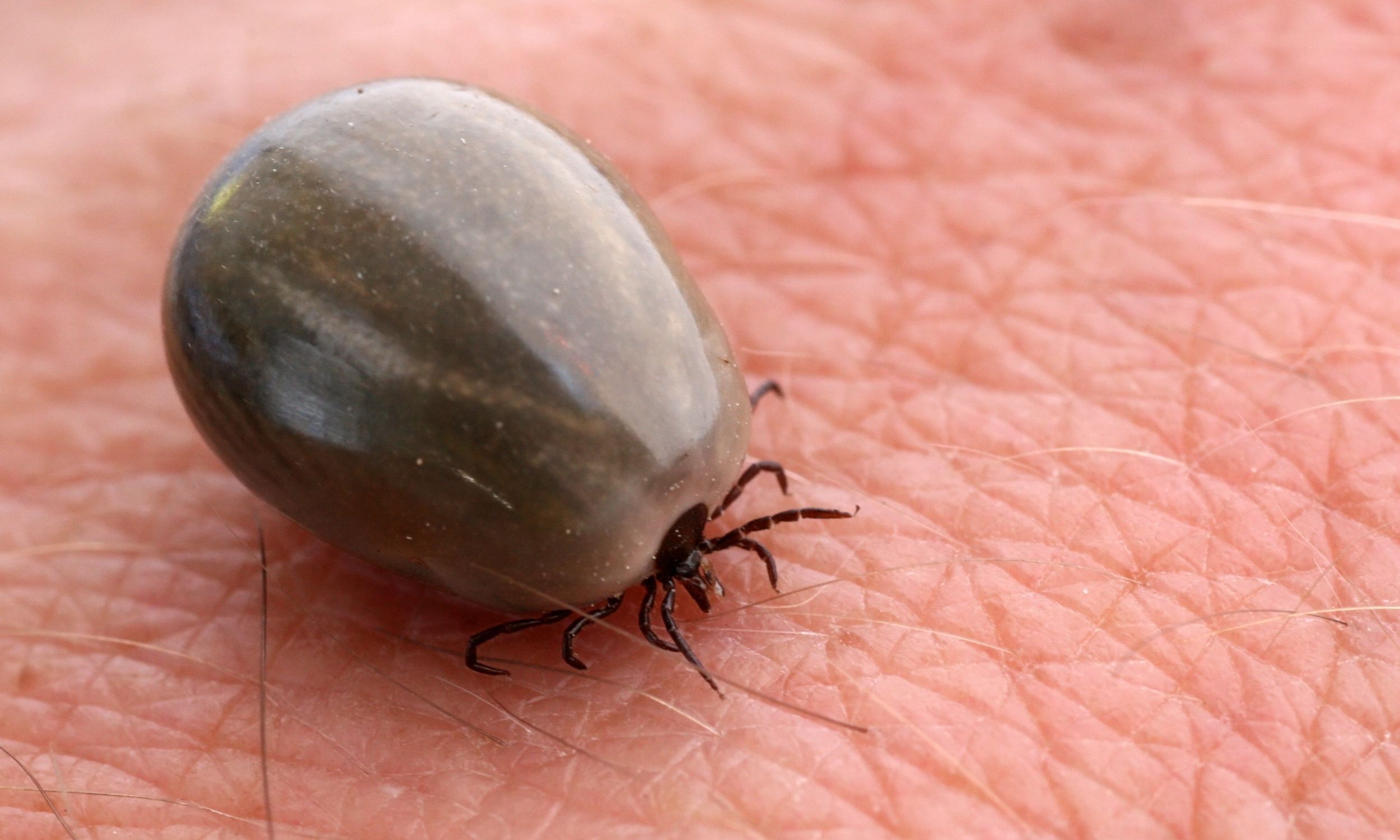 Researchers question link between tick bites and chronic illness ...