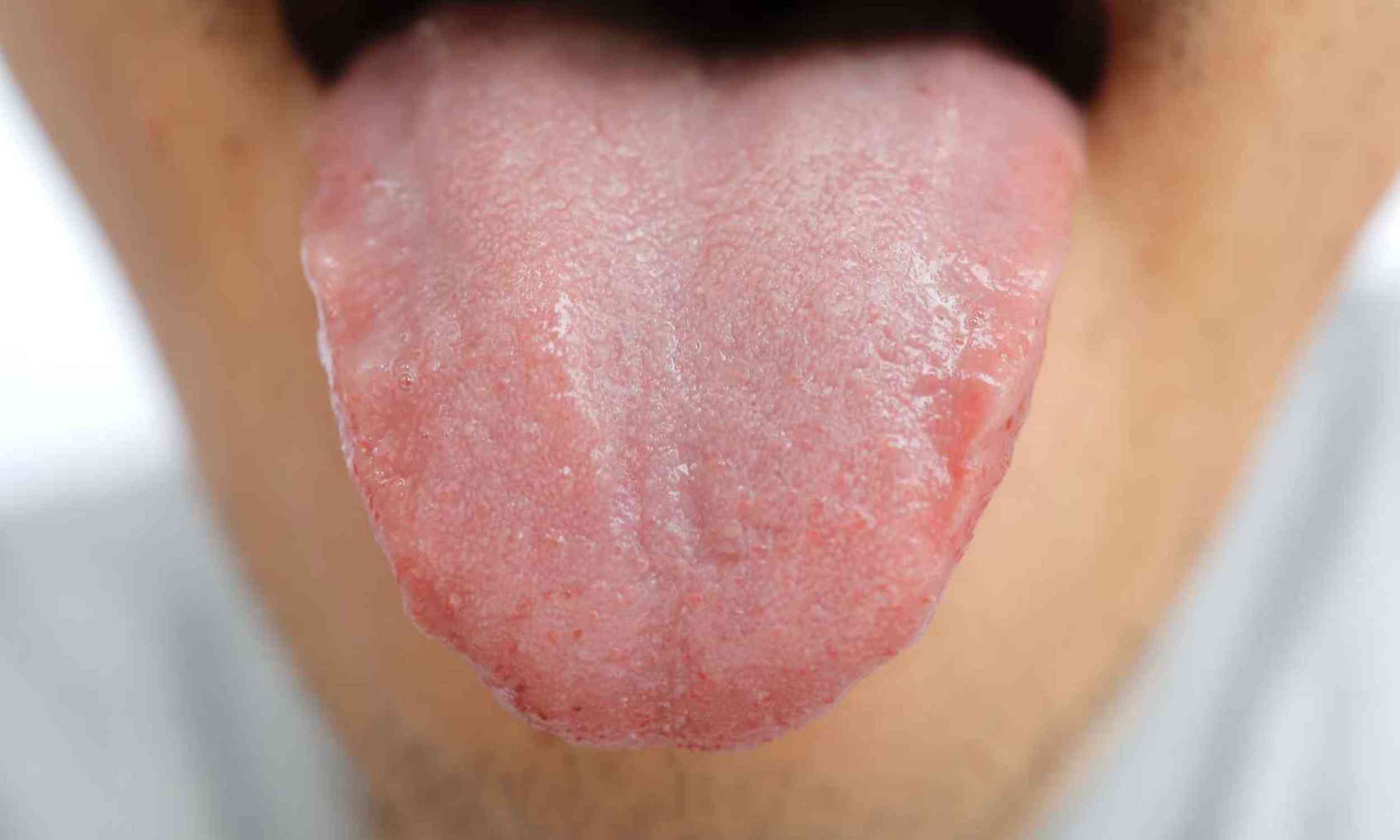 A tongue swab could make tuberculosis testing far easier - Earth.com