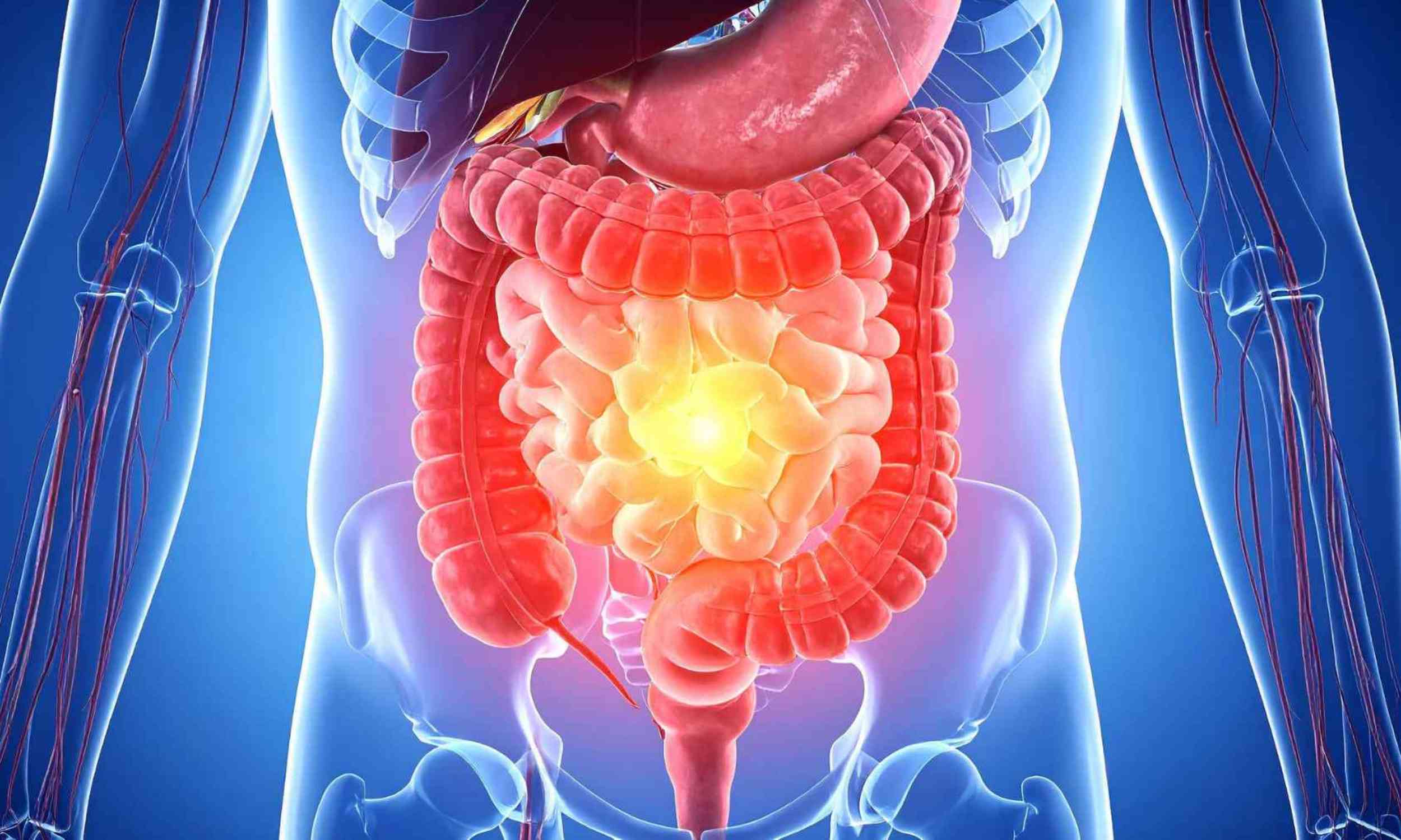 No superfood needed, a large study links lower colorectal cancer risk ...