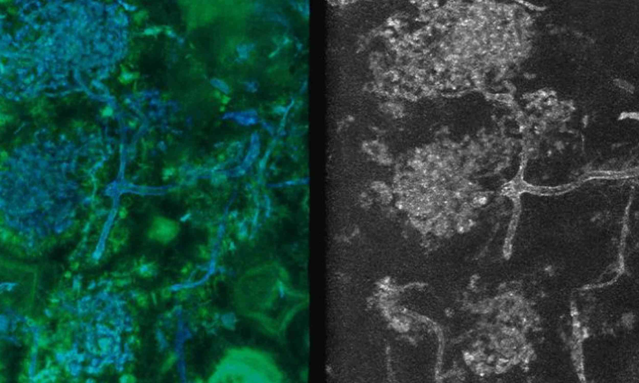 Ancient plant fossil contains a new species of symbiotic fungus - Earth.com