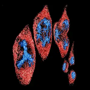 Scientists built a 5D microscope that is so advanced it needs an AI ...
