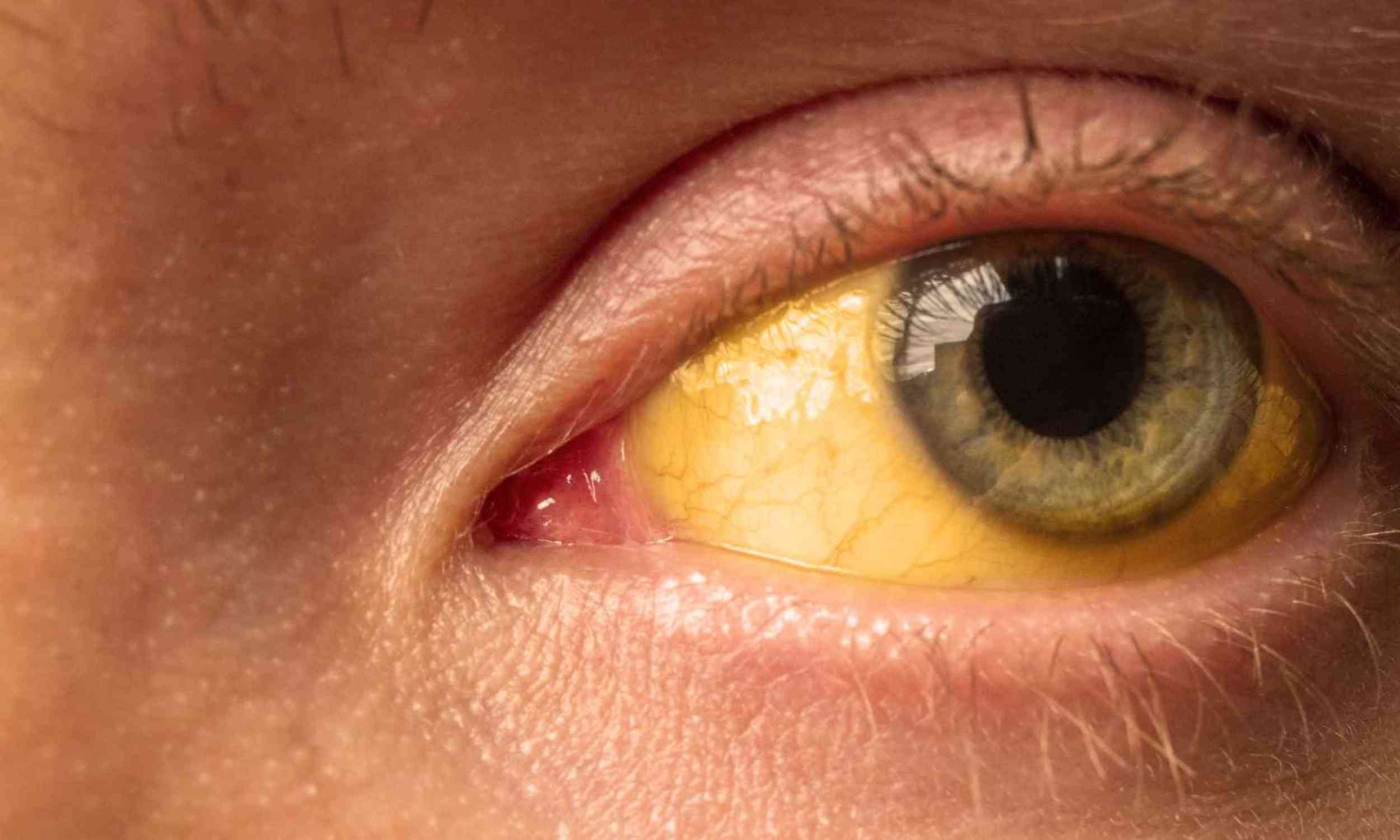 A single shot may help the immune system fight hepatitis B, and the ...