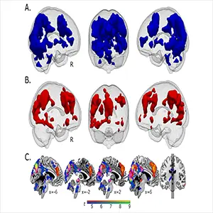 Scientists discover what happens in the brain during disorienting déjà ...
